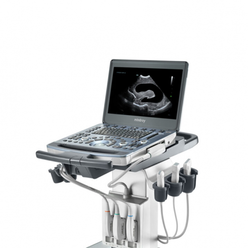 Mindray M8 Ce Approved Portable Ultrasound Scanner 3d Ultrasound ...